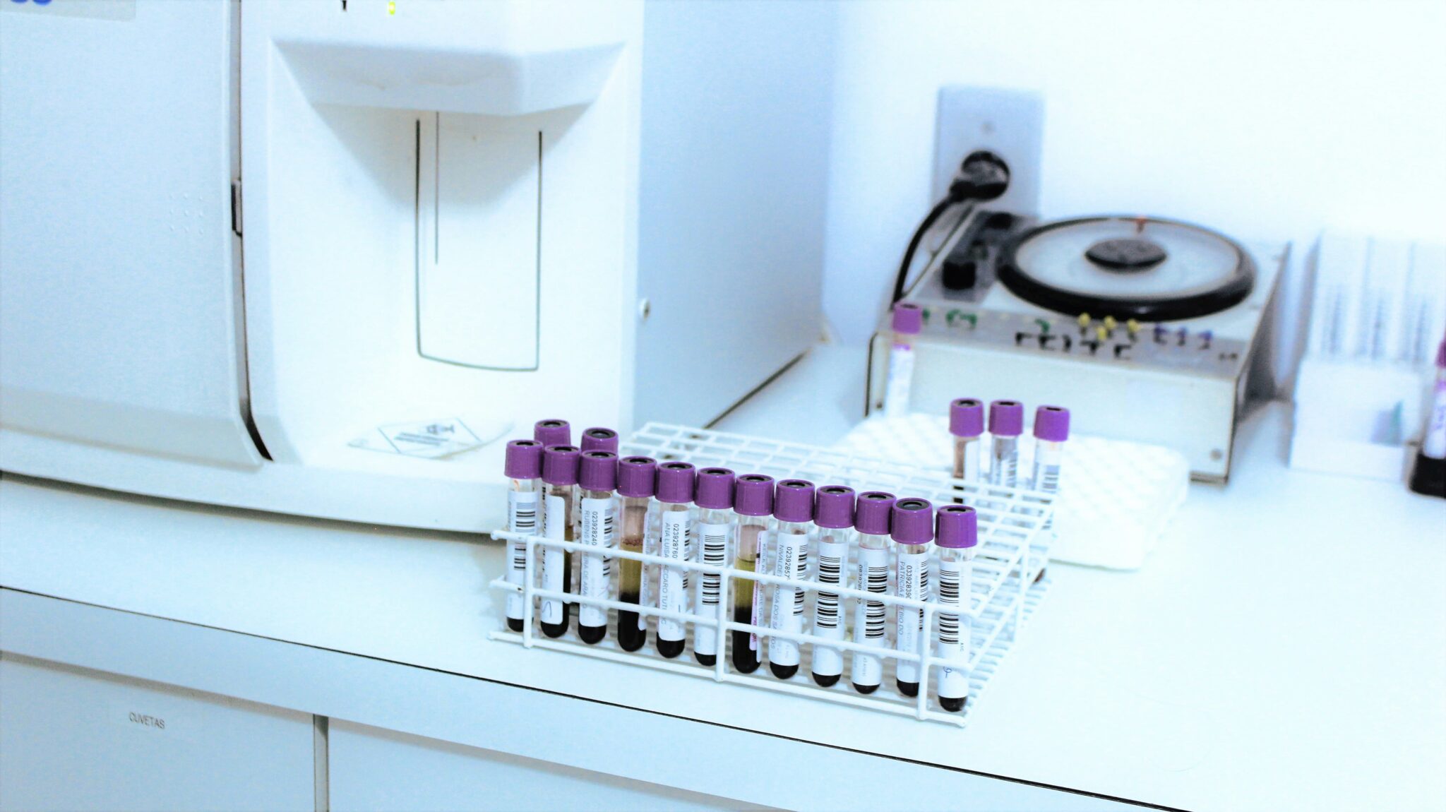 CA 125 e CA 19-9: Para Que Servem Esses Exames de Sangue?